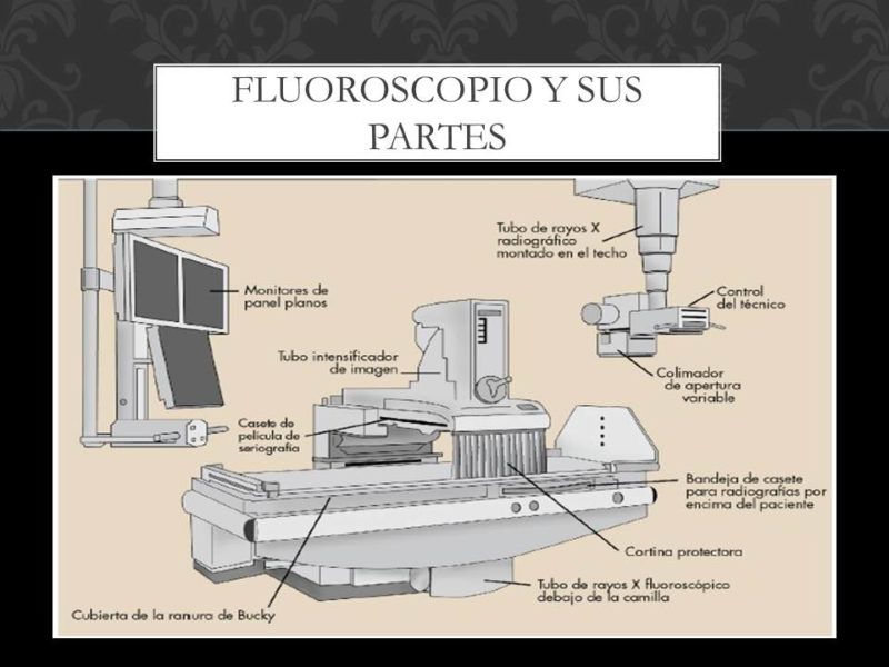 EXAMEN DE FLUOROSCOPIA | El Blog de Godie